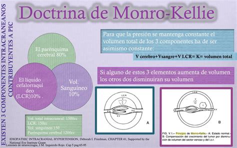 Hipótesis De Monro Kellie