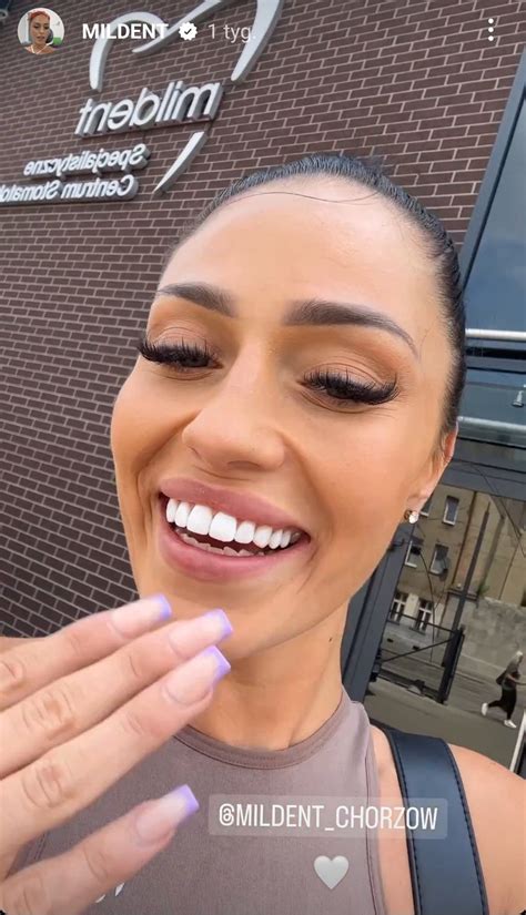 Beata Kurpas Z Love Island Zrobiła Sobie Nowe Zęby Fortepian Ibisza To Przy Tym Nic