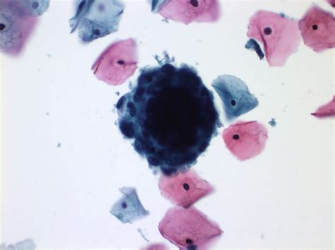 Normal Endometrial Cells