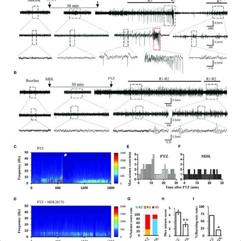 Electroencephalograph Eeg And Behavioral Analysis Showing
