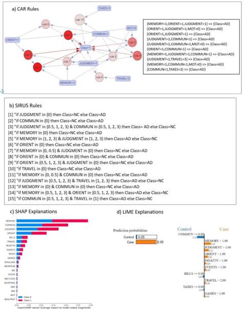 An Explainable Machine Learning Approach For Alzheimers Disease Aparajeeta Guha