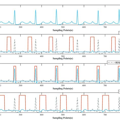 Raw Ecg And P Wave Qrs Complex T Wave Download Scientific Diagram
