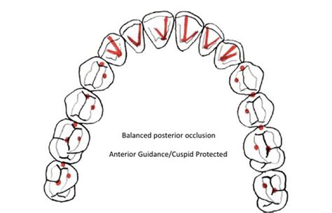 Occlusion Flashcards Quizlet