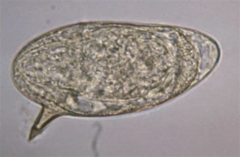 Week 5 Flashcards Quizlet