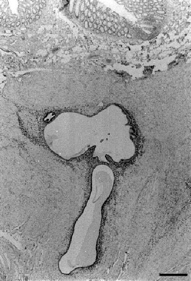 Macroscopic Section Through The Lesion At The Mesenteric Side From Download Scientific Diagram