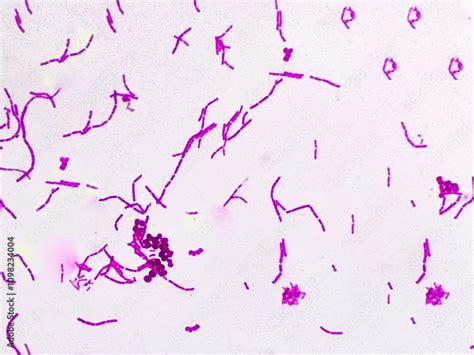 Poster Streptococcus Pneumonia Bacteria Cells And Candida Albican Poster Streptococcus Pneumonia Bacteria Cells And Candida Albican