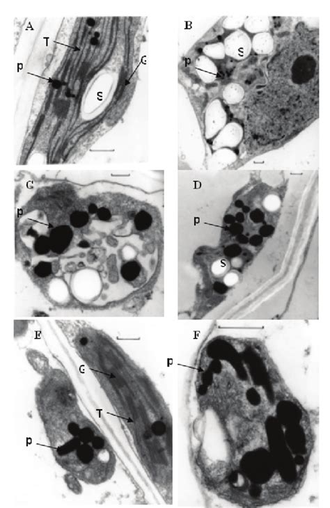 Electron Micrographs Of Plastids In Subepidermal Cell Layers Of Both Download Scientific