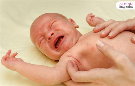 What Is Torch Infection How Does It Affect Pregnancy