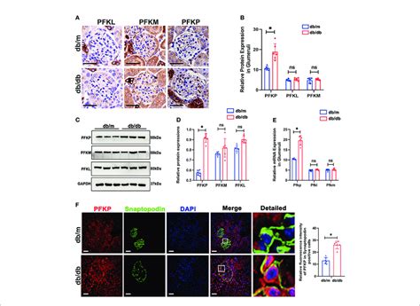 pfk expressions in db m and db db mice a b representative