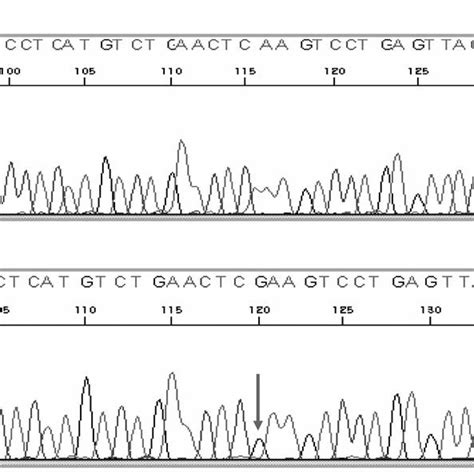 Kit Gene Mutation In Exon 9 A Wild Type B Dna Sequence Of A Download Scientific Diagram