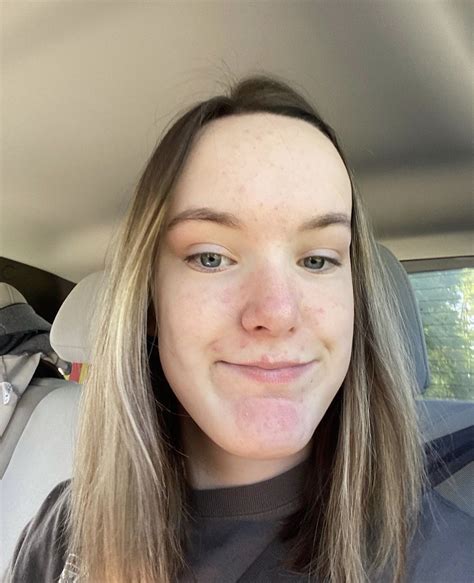 White Girl With Big Forehead Big Forehead White Girls Forehead