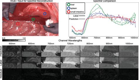 Healthcare Technology Letters Vol 11 No 6