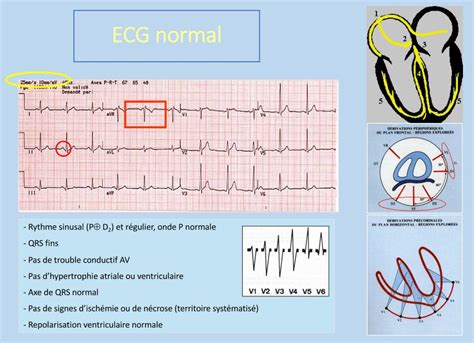 Illustrations Exemples Schémas