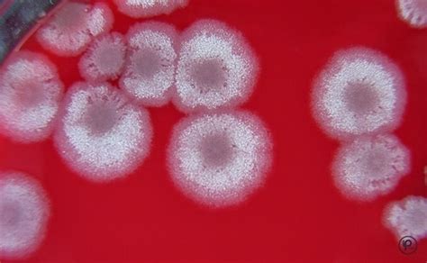 Aerobic Gram Positive Bacilli Flashcards Quizlet