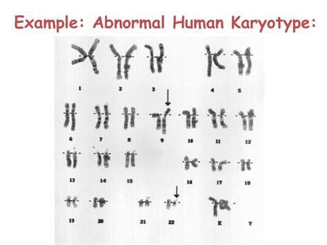 Ppt Karyotype Lab Powerpoint Presentation Free Download Id2284146