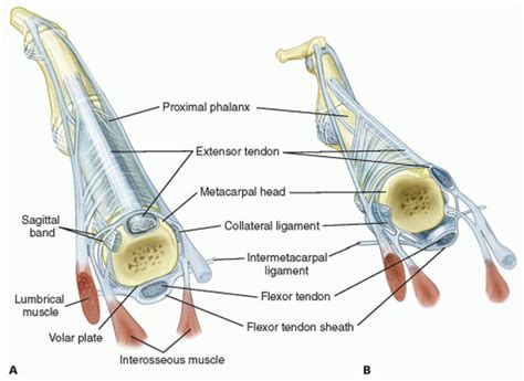 Metacarpophalangeal Joint Ligaments