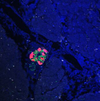 Use Script To Save Image With Threshold Overlay In QuPath Usage Issues Image Sc Forum