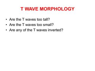 T WAVE IN ECG AND ITS ABNORMALITIES IN ECG PPTX
