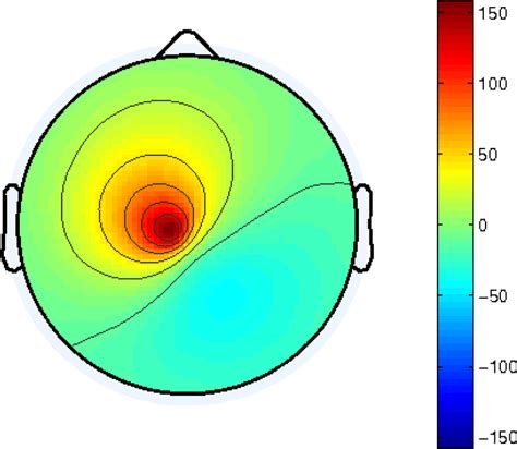 Eeg Potentials Generated Through Ab Ellipsoidal And C Bem Models