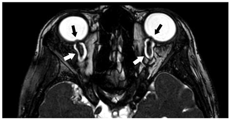 Axial Three Dimensional Constructive Interference In Steady State 3d Download Scientific