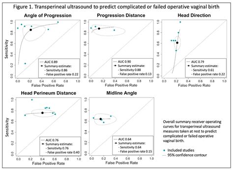 Prognostic Accuracy Of Ultrasound Measures Of Fetal Descent To Predict Outcome Of Operative