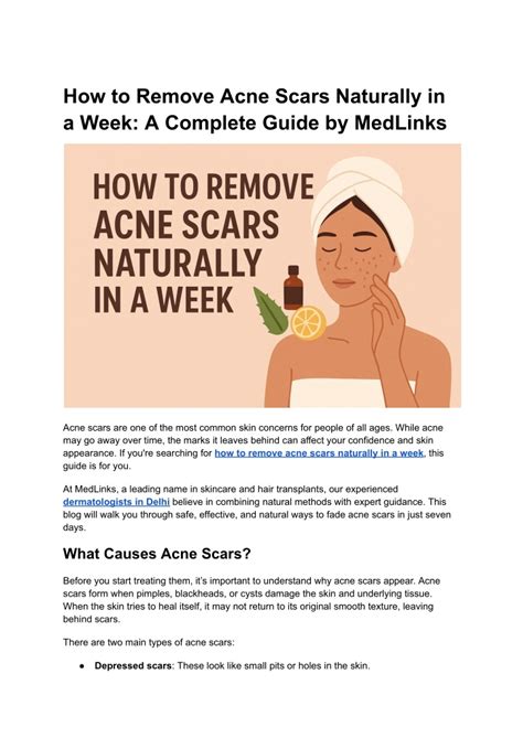 Ppt How To Remove Acne Scars Naturally In A Week A Complete Guide By