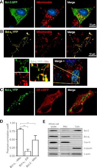 Differential Subcellular Distribution Of Bcl 2 And Bcl Xl In β Cells A