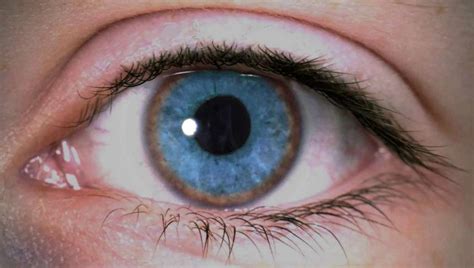 Wilsons Disease Faqs