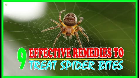 Top 10 Home Remedies Spider Bite At Kayla Omay Blog