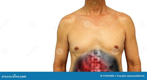 Small Intestine Duodenum And Vermiform Appendix Human Under The Microscope Stock Image