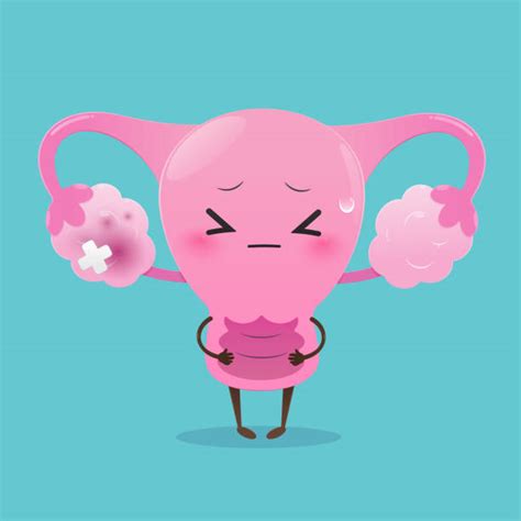 Uterine Cervix Cancer Stock Vectors Istock