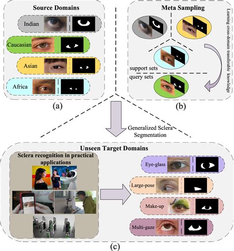 An Example Of The Proposed Metascleraseg For The Generalized Sclera