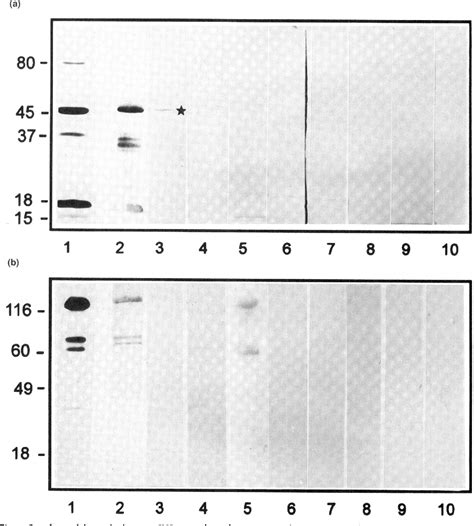Figure From Fate And Distribution Of Seminal Plasma Proteins In The Genital Tract Of The