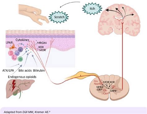 Figure From Management Of Cholestatic Pruritus In Primary Biliary Cholangitis Ileal Bile Acid