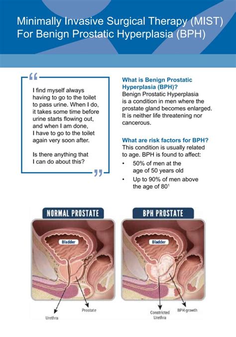 Exploring Surgical Interventions For Bph Ask The Nurse Expert