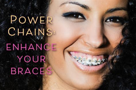 Success Stories Before And After Power Chain Braces Power Chains Braces