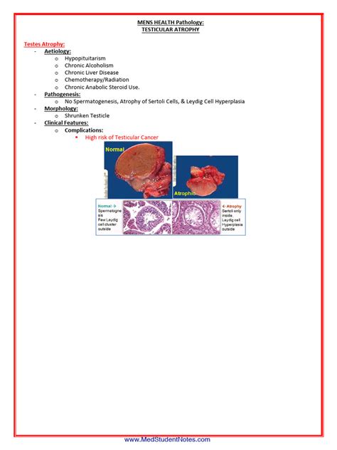 Mens Testicular Atrophy 1p Pdf