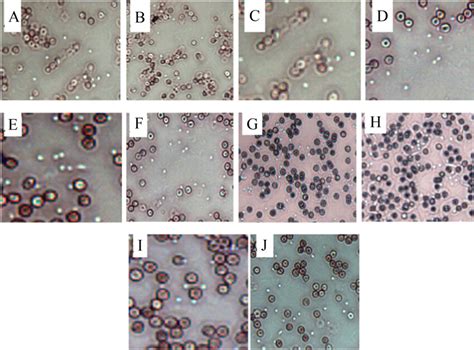 Distribution Of PLT In Blood Samples For Control And Exposed Samples Download Scientific