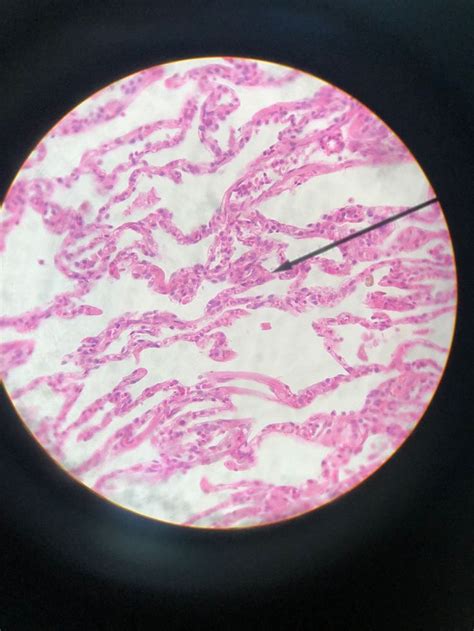 Simple Squamous Epithelial Tissue Lung