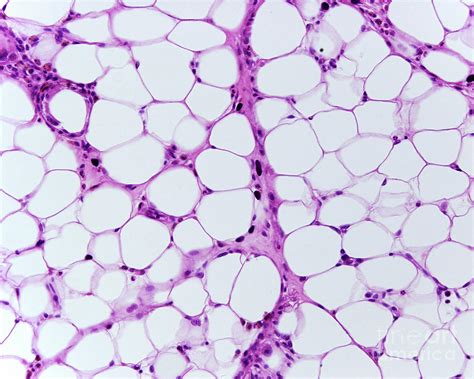 Adipose Tissue Under Microscope