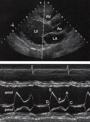 Doppler Echo Waveforms And Myocardial Segments Exam 1 Flashcards Quizlet