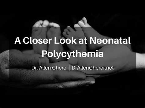 Polycythemia At Birth Polycythemia Neonatal Gjdju