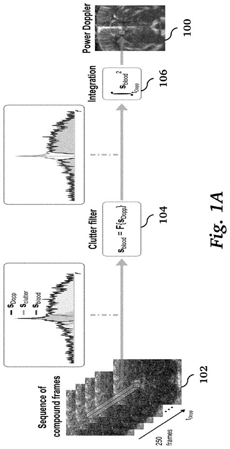 Functional Ultrasound Imaging Of The Brain Using Deep Learning And Sparse Data Eureka Patsnap