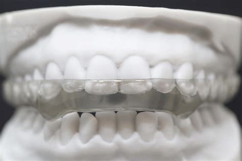 Hard Occlusal Splint Rdl Russellville Dental Lab