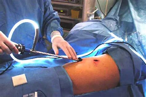 Thoracoscopy Dr Amit Kumar Pulmonary Medicine And Chest Specialist