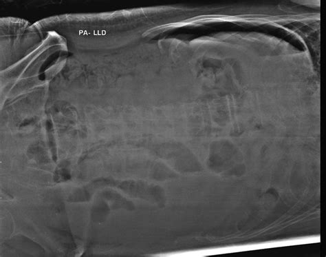 Abdomen X Ray In Left Lateral Decubitus Showing Free Air In The Download Scientific Diagram