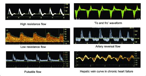 Spectral Inflections In V T Curve Diagrams Illustrate How Normal Download Scientific Diagram