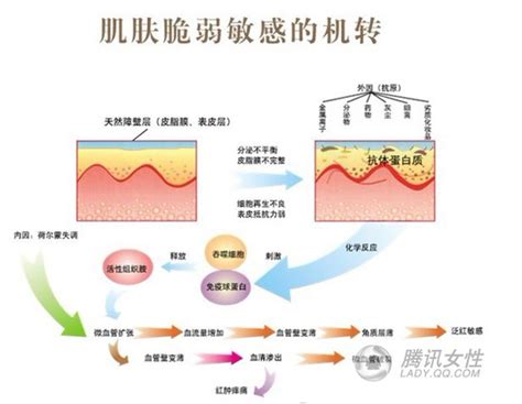 敏感肌肤 敏感肌 万县网