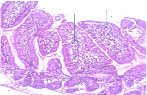 Lactobacillus Metronidazole Treated Group Normal Villi With Mild Download Scientific Diagram