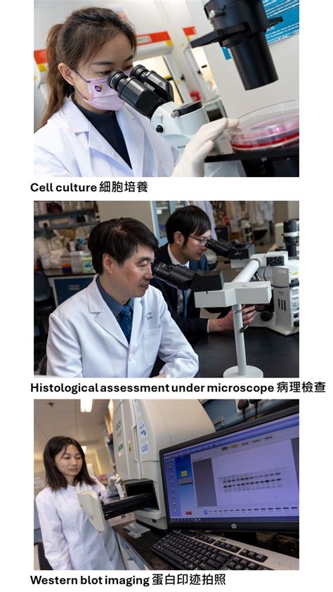 Cuhk Identifies Streptococcus Anginosus As A Pathogen That Promotes Gastric Tumour Formation